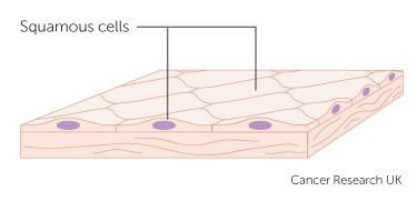 Types of cancer | Cancer Research UK