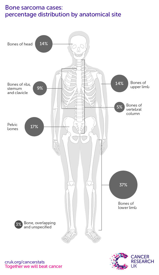 Bone sarcoma incidence statistics | Cancer Research UK